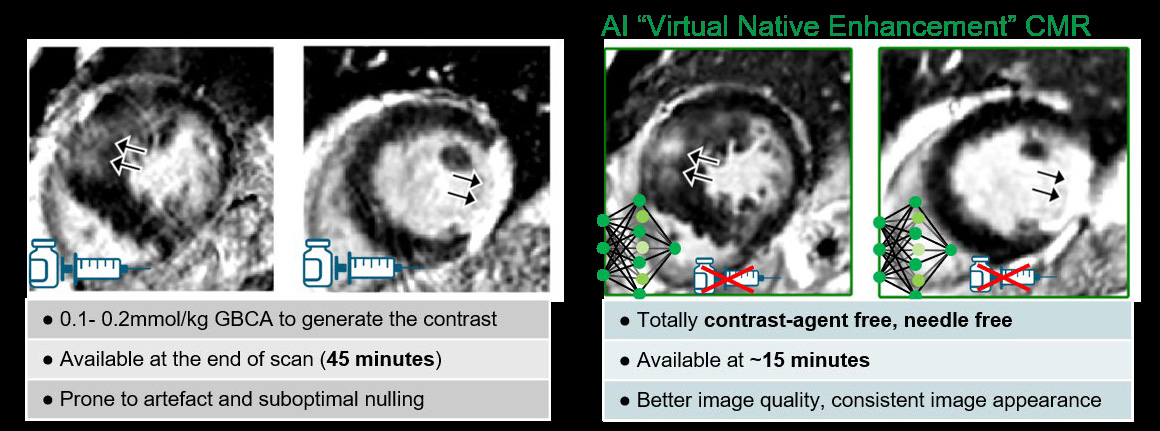 Virtual native enhancement –a gadolinium-free, needle-free method for ...