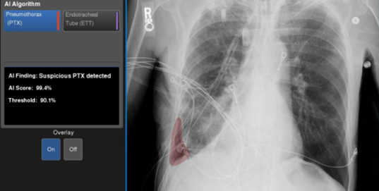 Oxford-NHS Study validates GE Healthcare AI medical software for ...