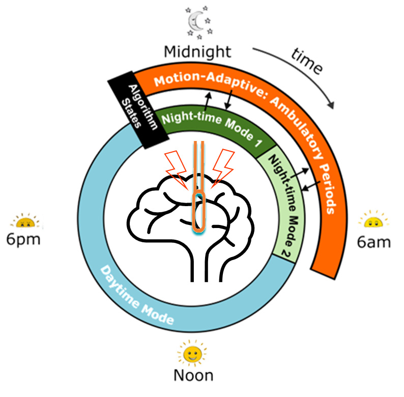 Closed Loop Deep Brain Stimulation To Influence Sleep State Oxford University Innovation