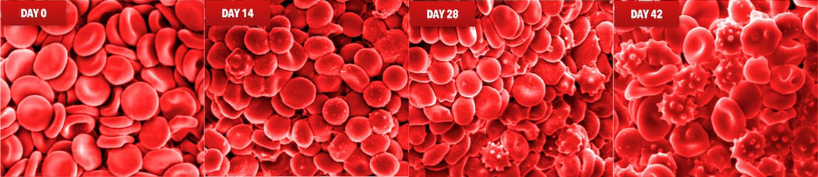 Flowscore is a cost-effective, sensitive, and specific flow-cytometric ...