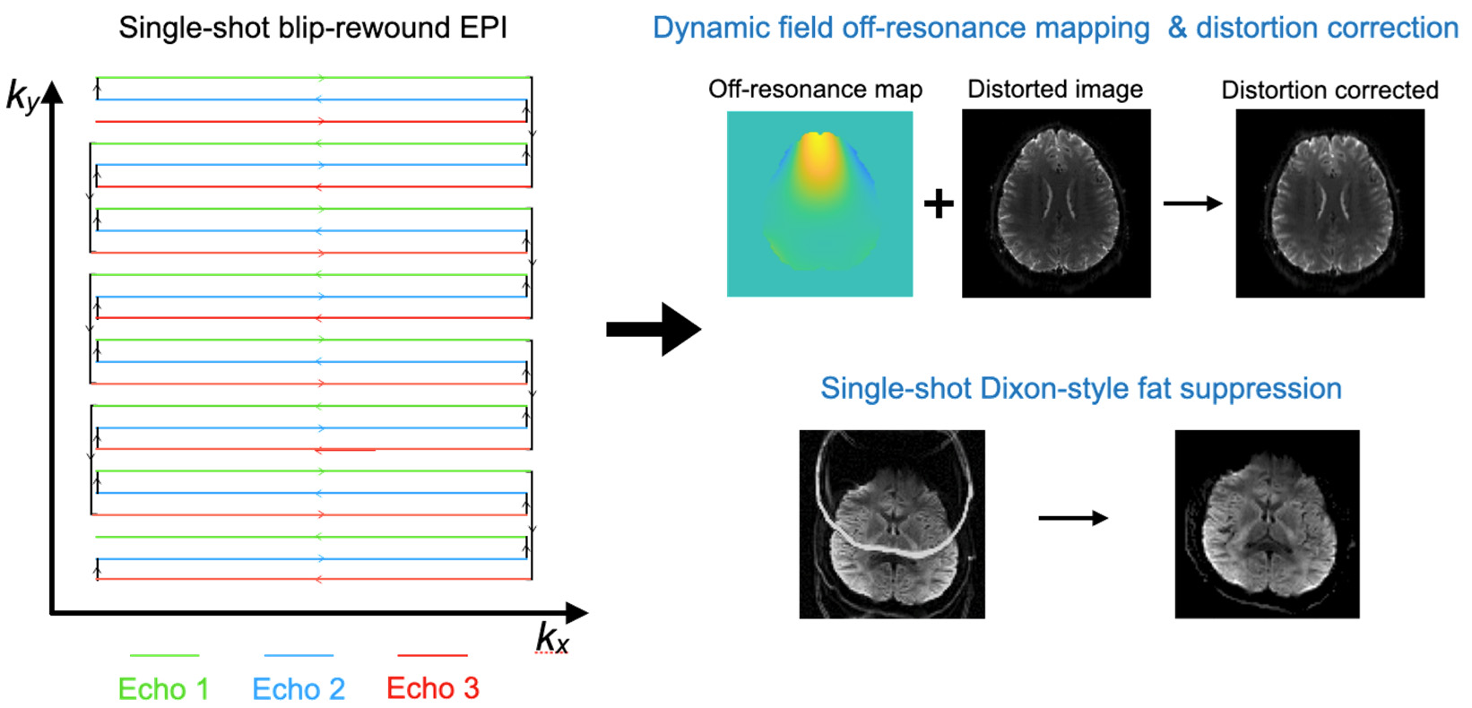 Dynamic distortion correction for improved EPI image quality in MRI - Oxford University Innovation